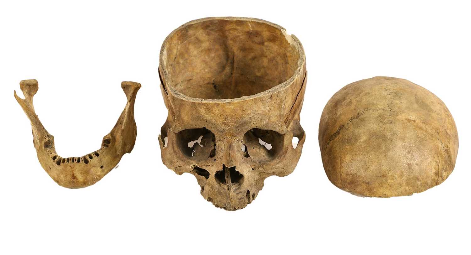 Lot 2200 - Human Skull