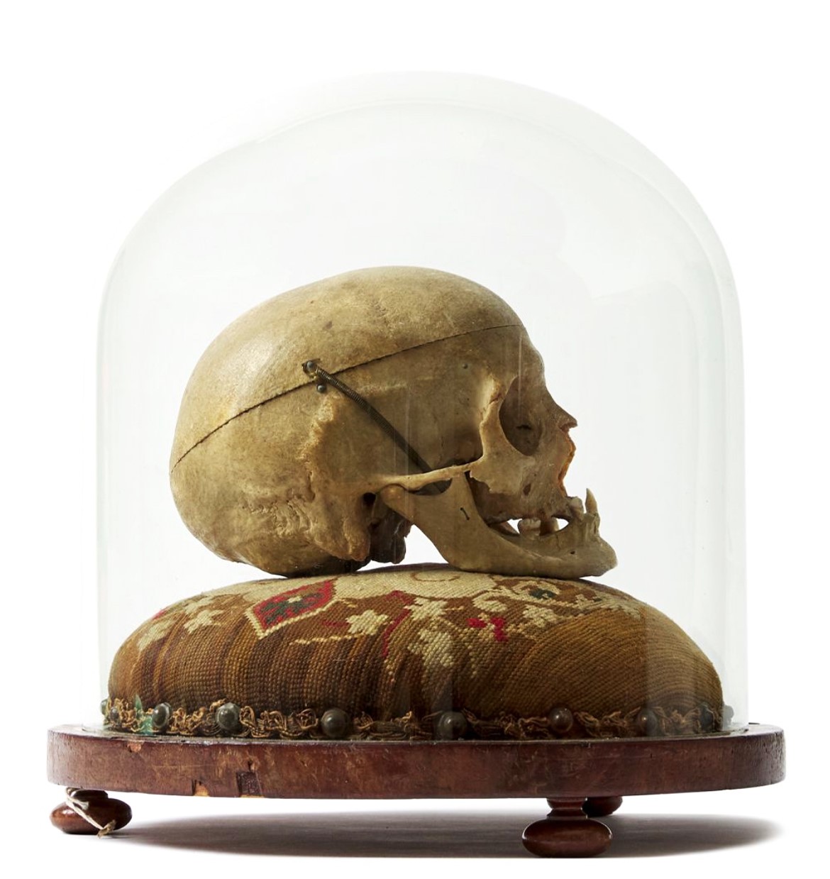 Lot 192 - Skulls/Anatomy: A Preserved Human Skull,
