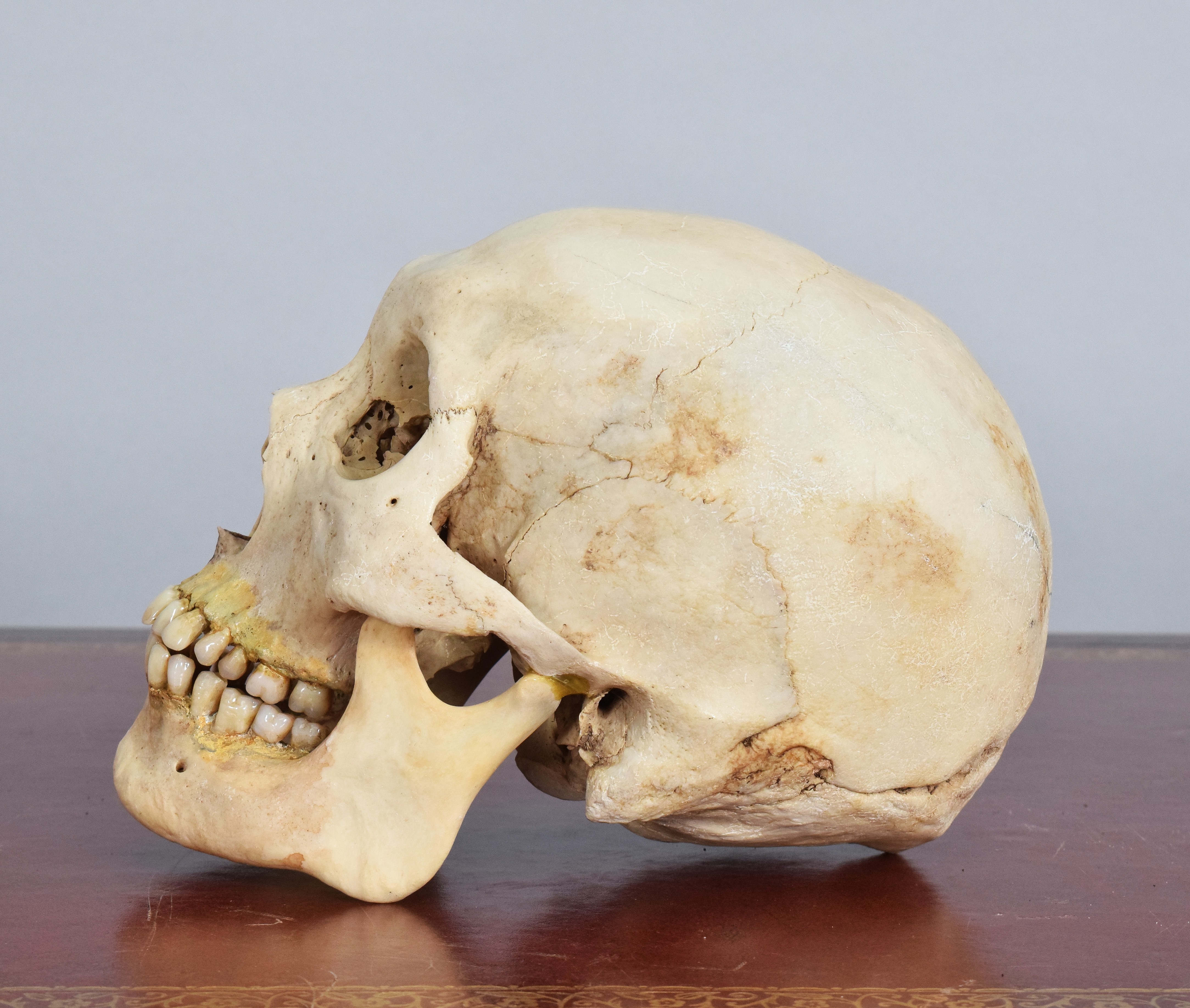 Lot 139 - Human Skull