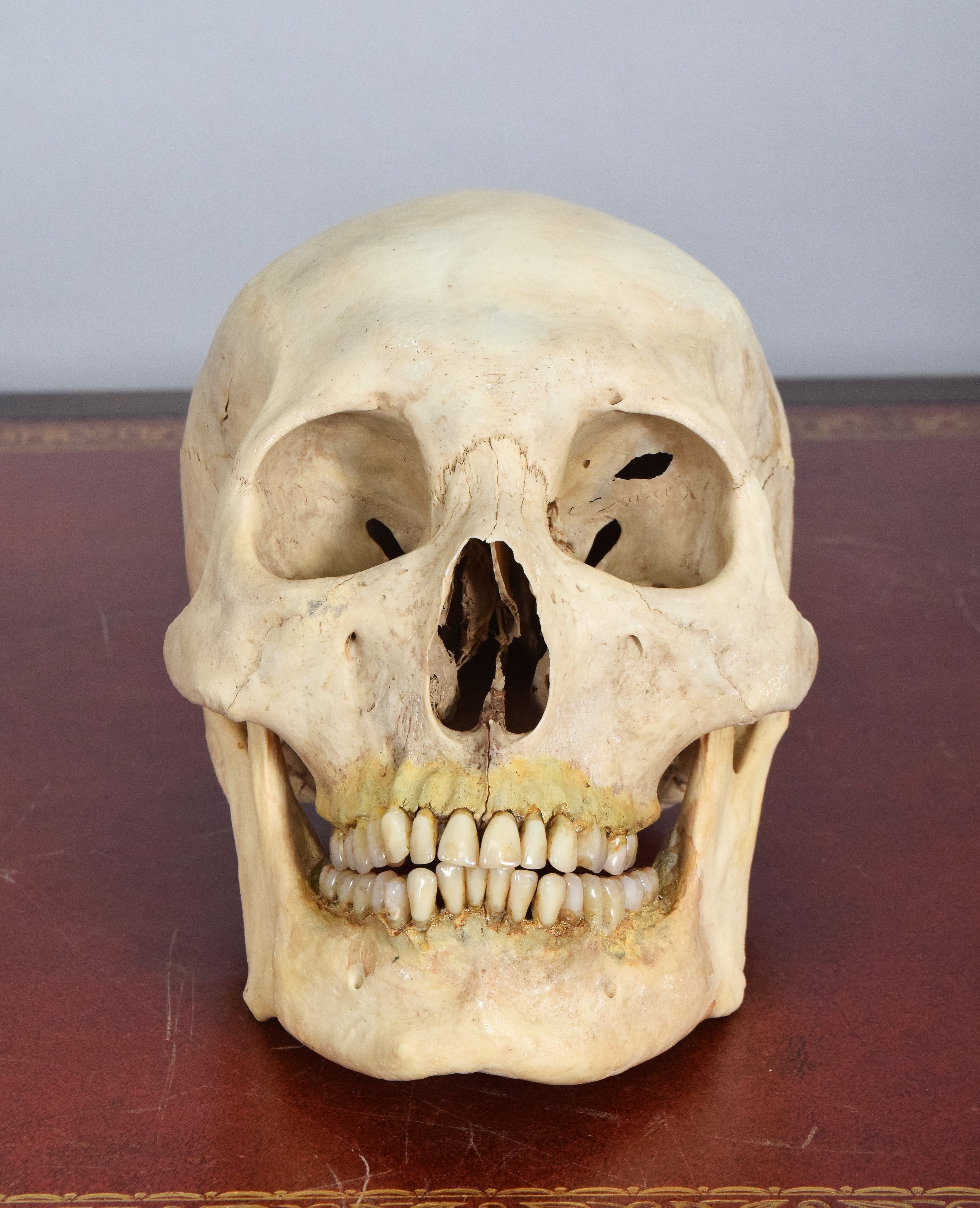 Lot 139 - Human Skull