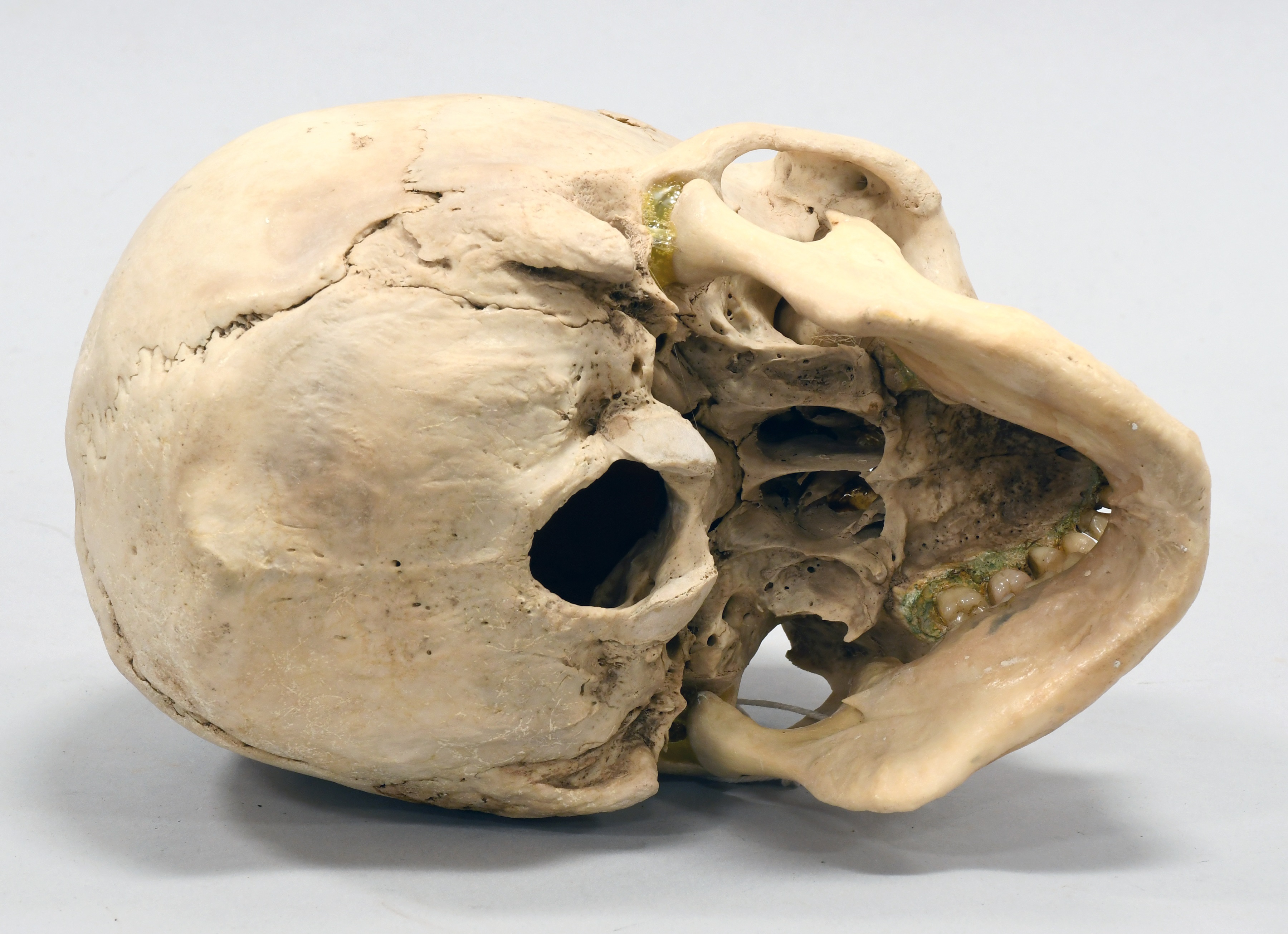 Lot 139 - Human Skull